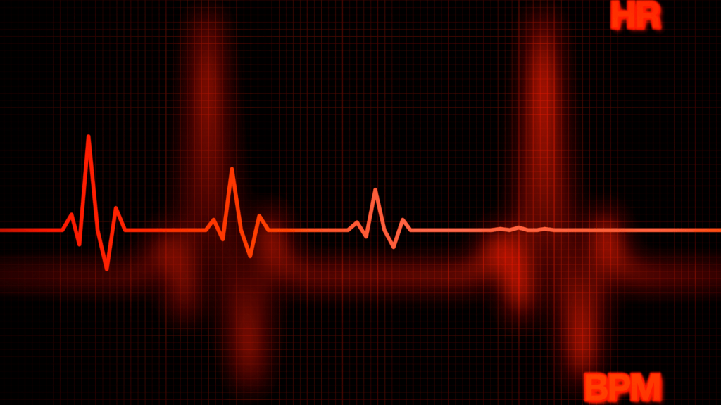 What a Triathlete should know about Heart Rate Variability ...